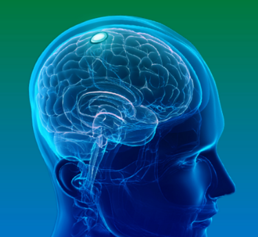 UAE-PRIME Trial: Neuralink and Cleveland Clinic Abu Dhabi Collaborate ...