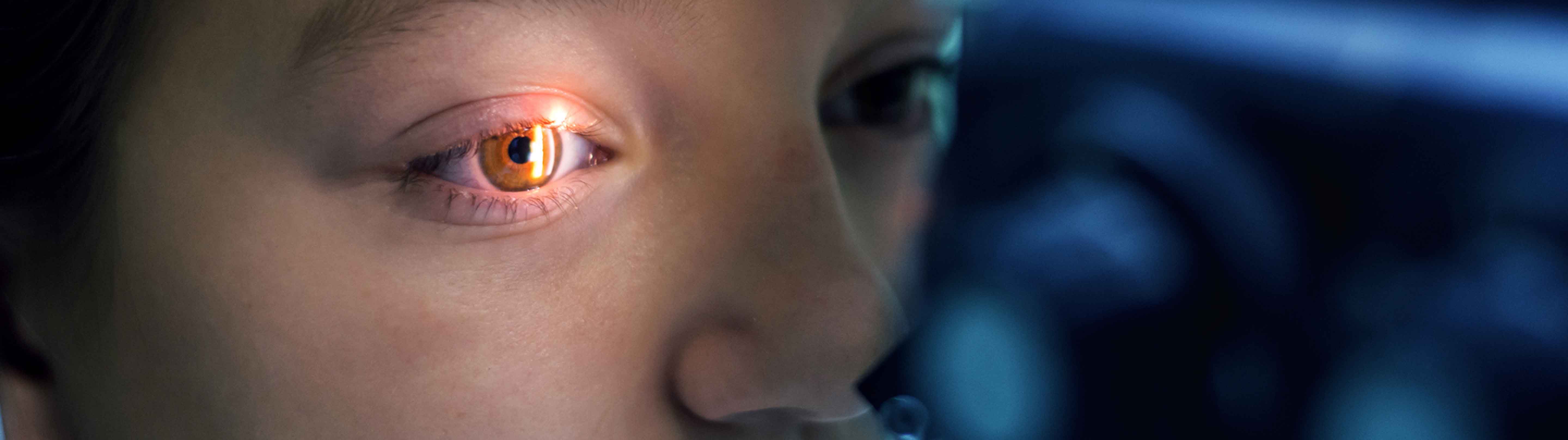 Intraocular Melanoma: Symptoms, Causes, Diagnosis & Treatment