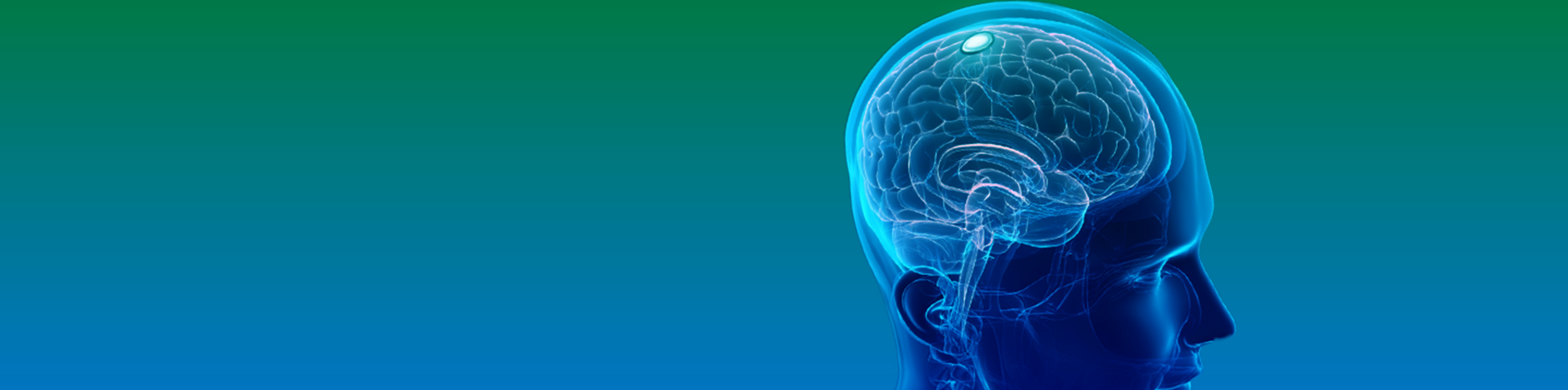 What to Expect With an MRI (Magnetic Resonance Imaging) Scan