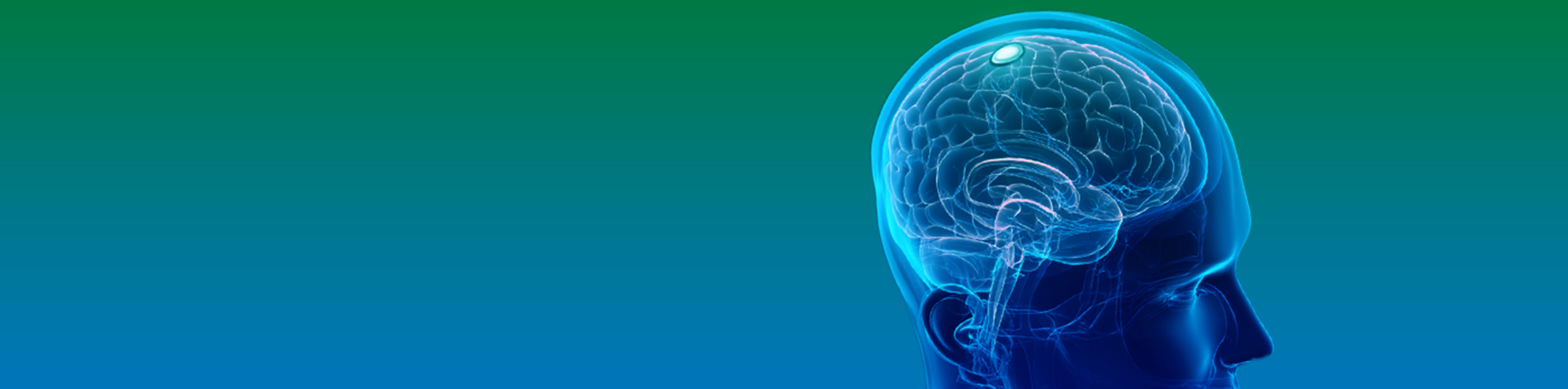 What to Expect With an MRI (Magnetic Resonance Imaging) Scan